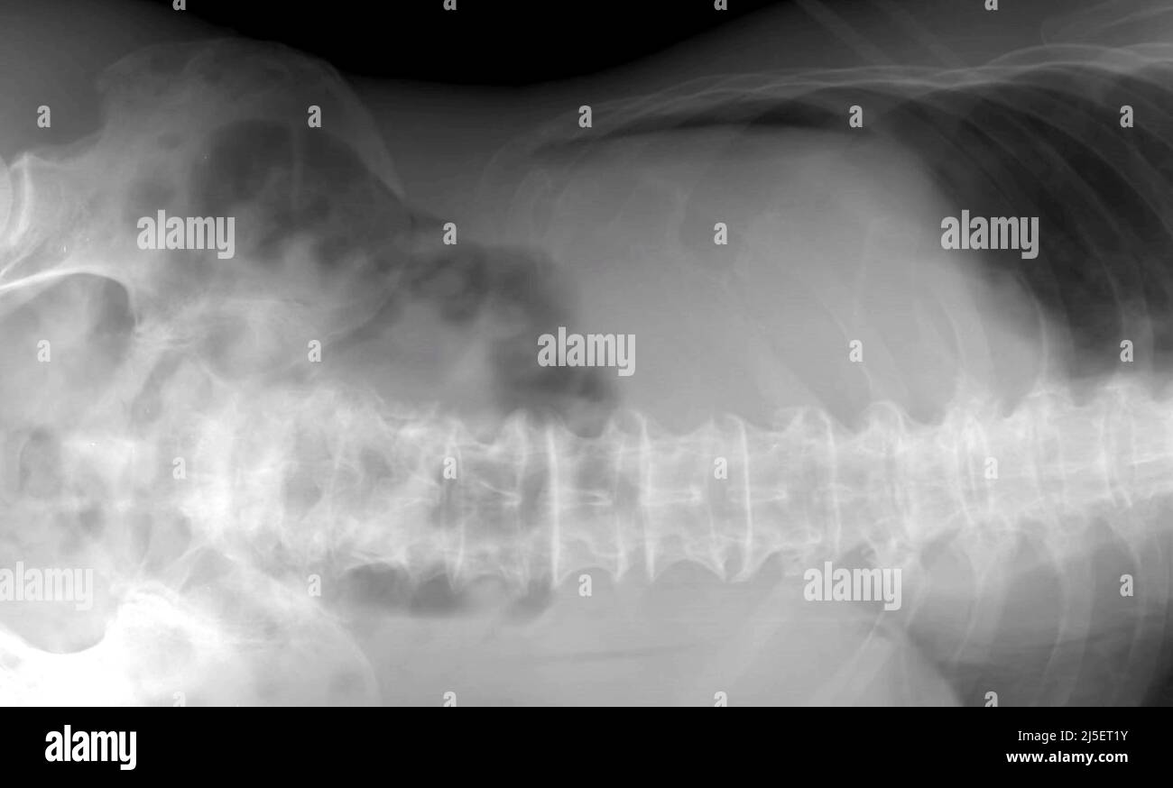 Diagnose diagnosis hi-res stock photography and images - Alamy