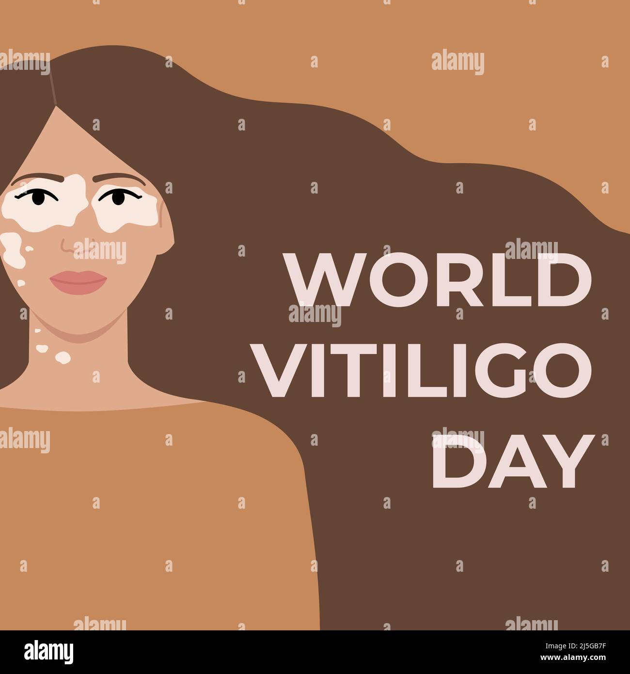 World vitiligo day June 25 square banner. Face of tan woman with ...