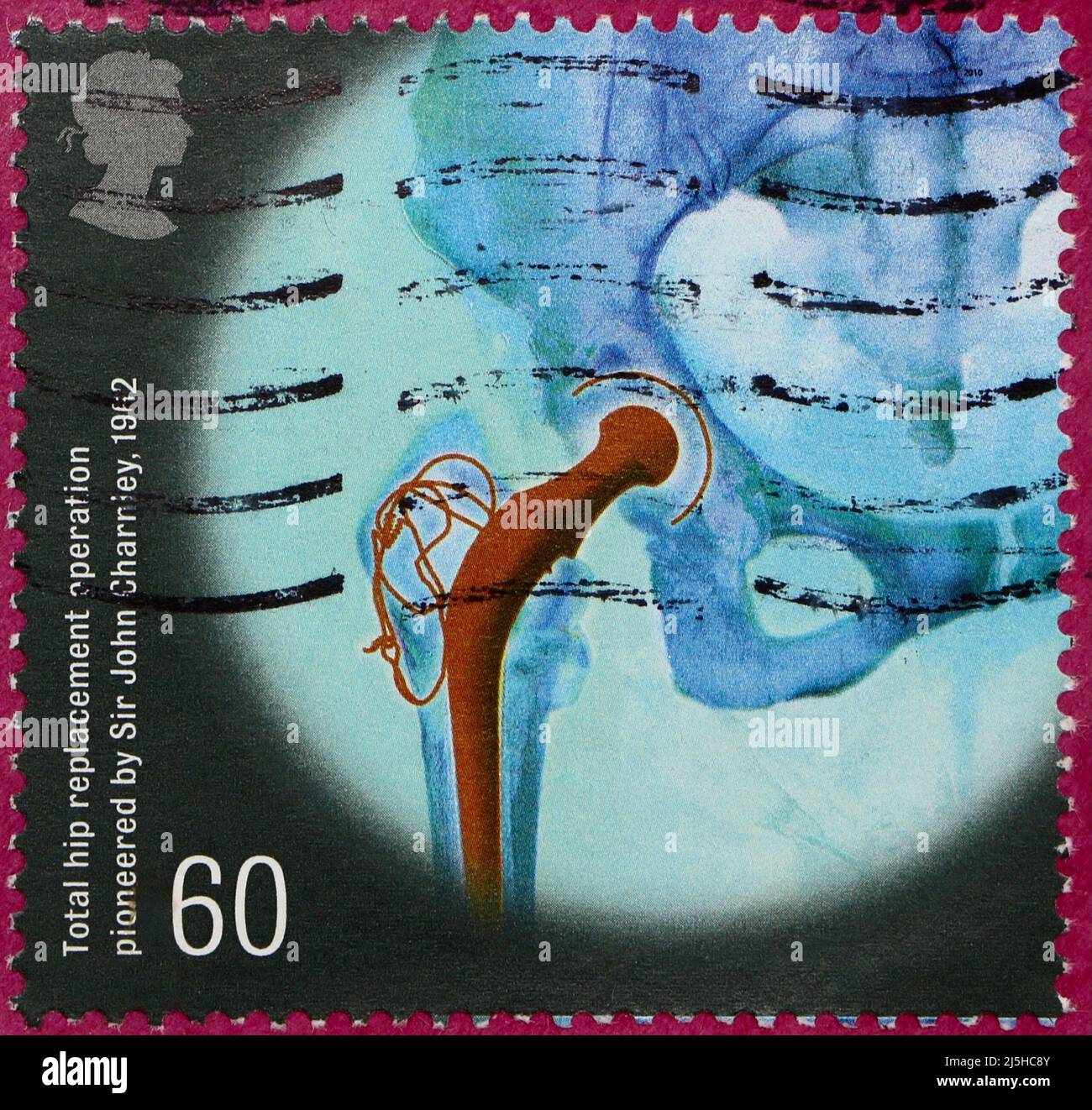 Photo of a British postage stamp from the Medical breakthroughs series ...