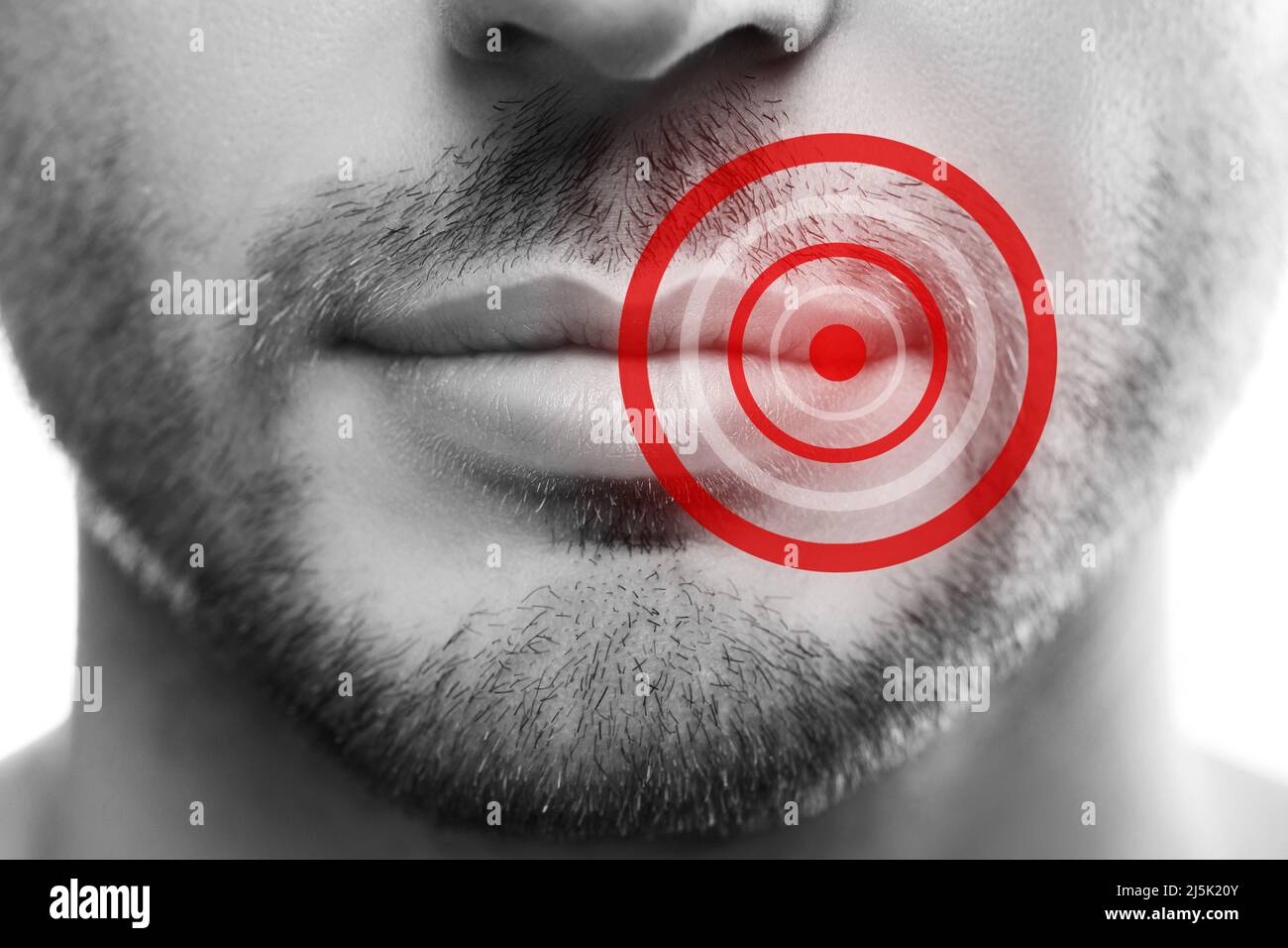 Closeup of male lips with a red circles. Signal of problems such as ...