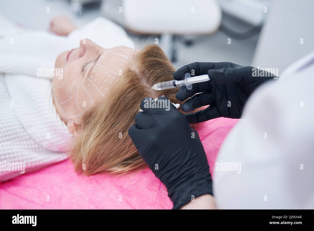 Woman receiving injection into scalp during mesotherapy treatment Stock ...