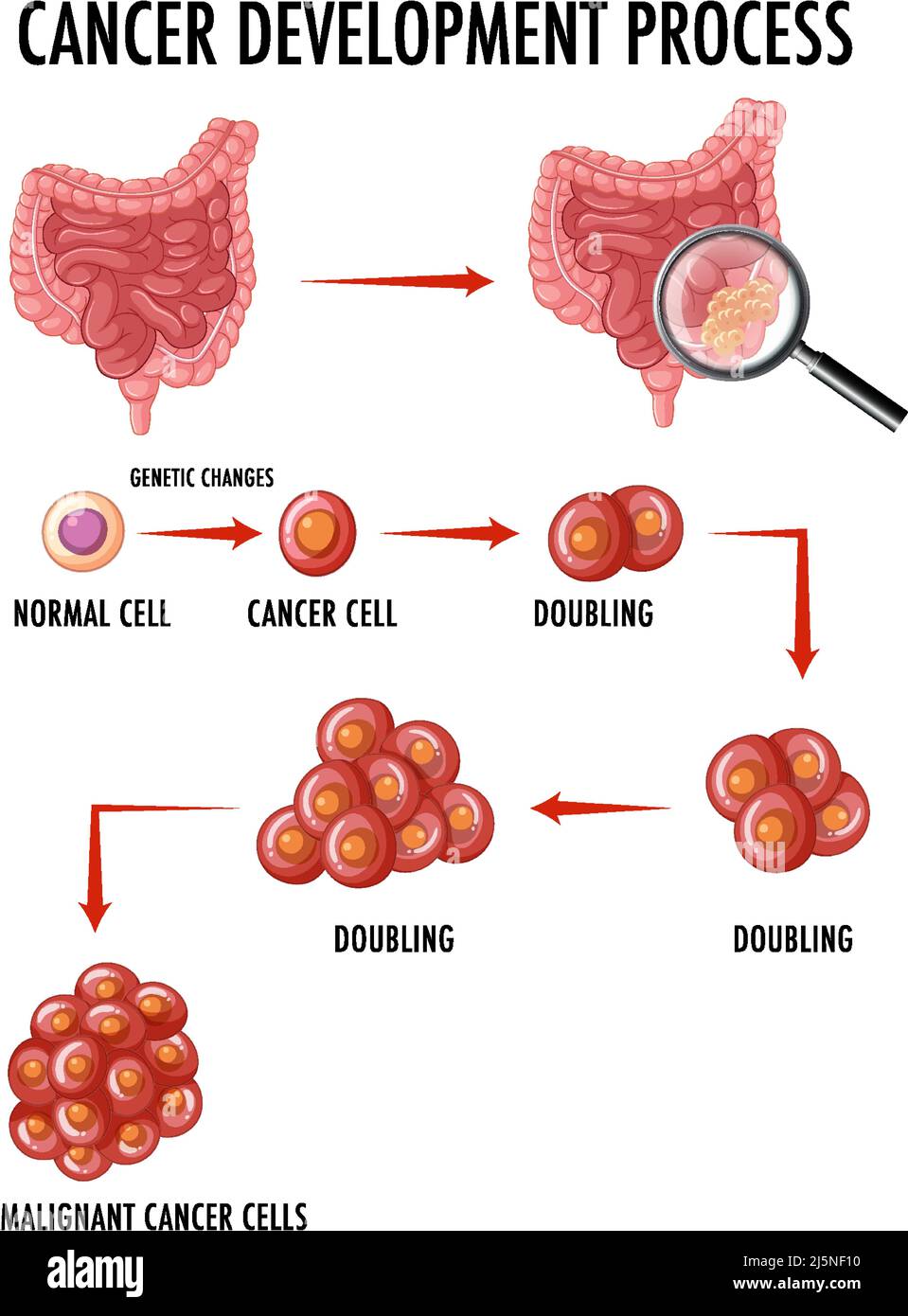 Diagram showing cancer development process illustration Stock Vector ...