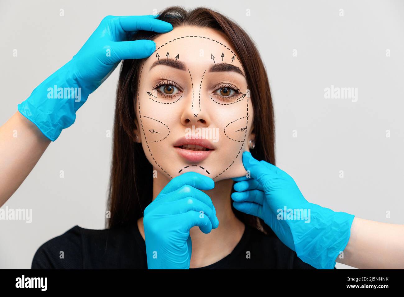 Portrait of a pretty young woman with surgical marks on her face ...