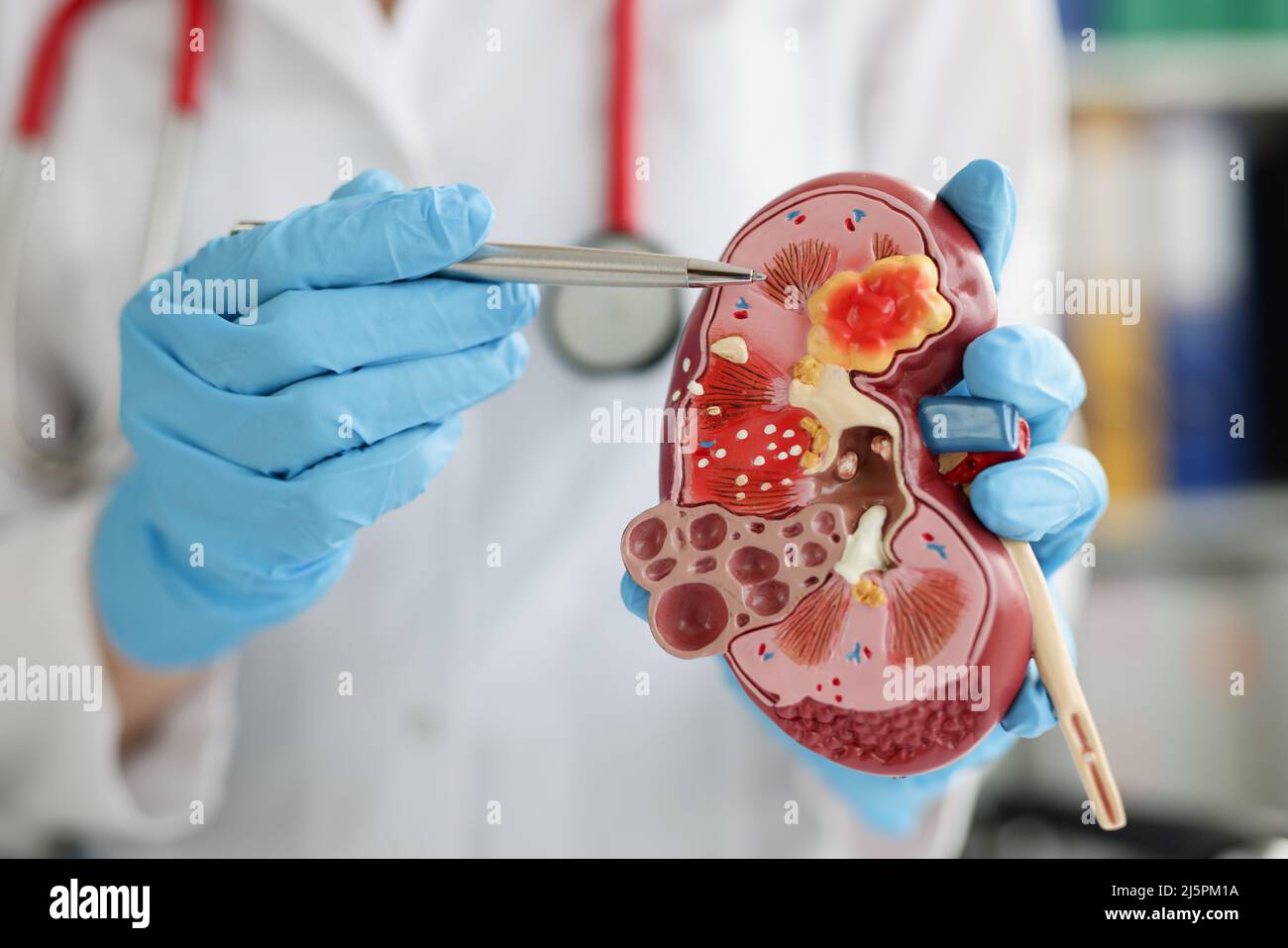 Urologist pointing pen kidney structure on anatomical model Stock Photo ...
