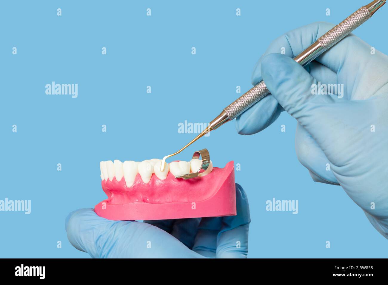 Dentist's hands with layout of the human jaw and dental restoration ...