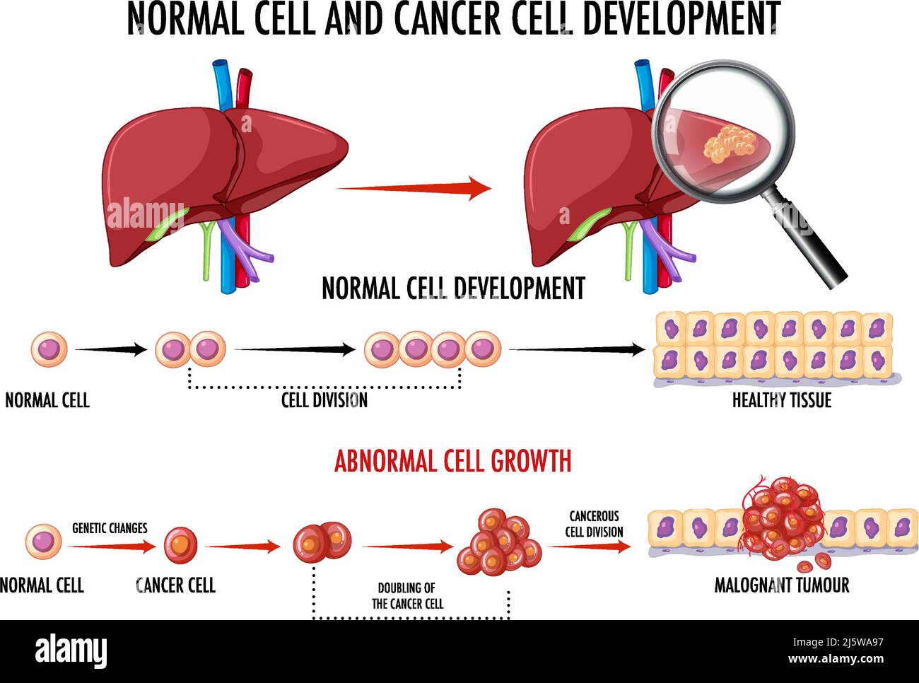 Diagram showing cancer development process illustration Stock Vector ...