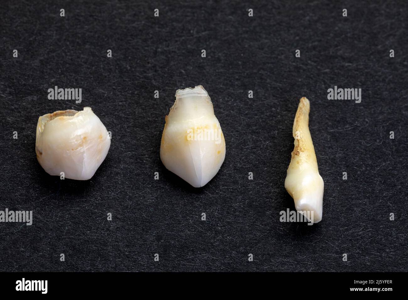 Newborn calfs teeths hi-res stock photography and images - Alamy