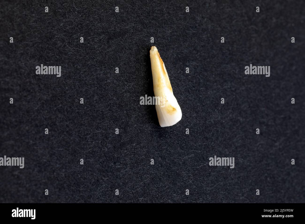 Extracted baby teeth hi-res stock photography and images - Alamy