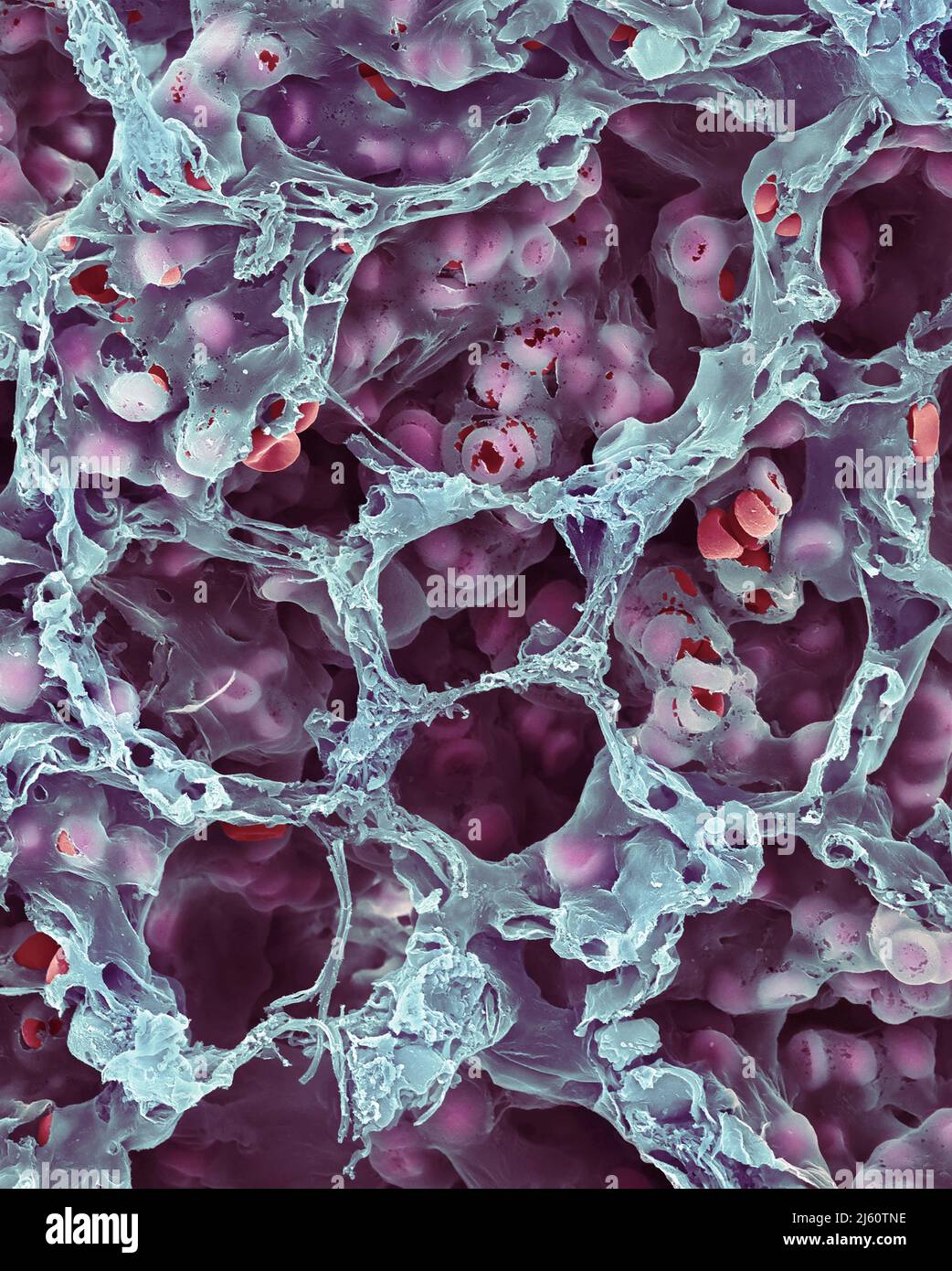 Lung tissue, SEM Stock Photo - Alamy