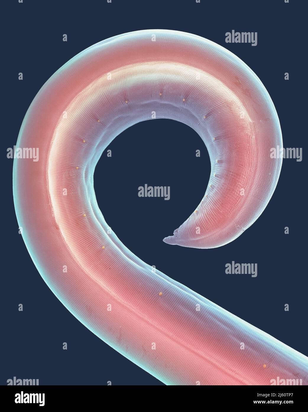 Dog roundworm, SEM Stock Photo - Alamy