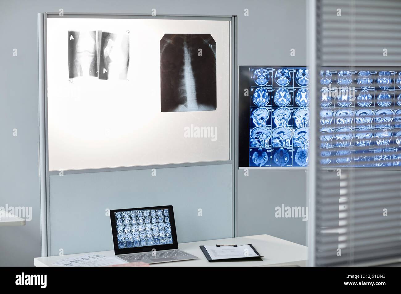 Horizontal no people shot of x-ray and tomography images printed and on ...