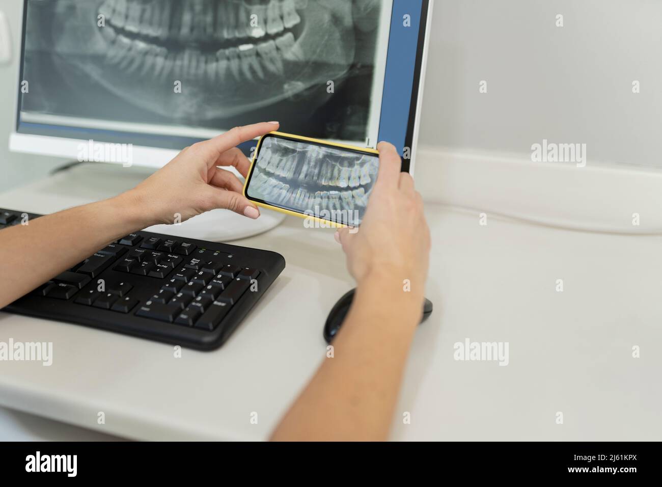 Dentist examining x-ray image through smart phone at dental clinic ...