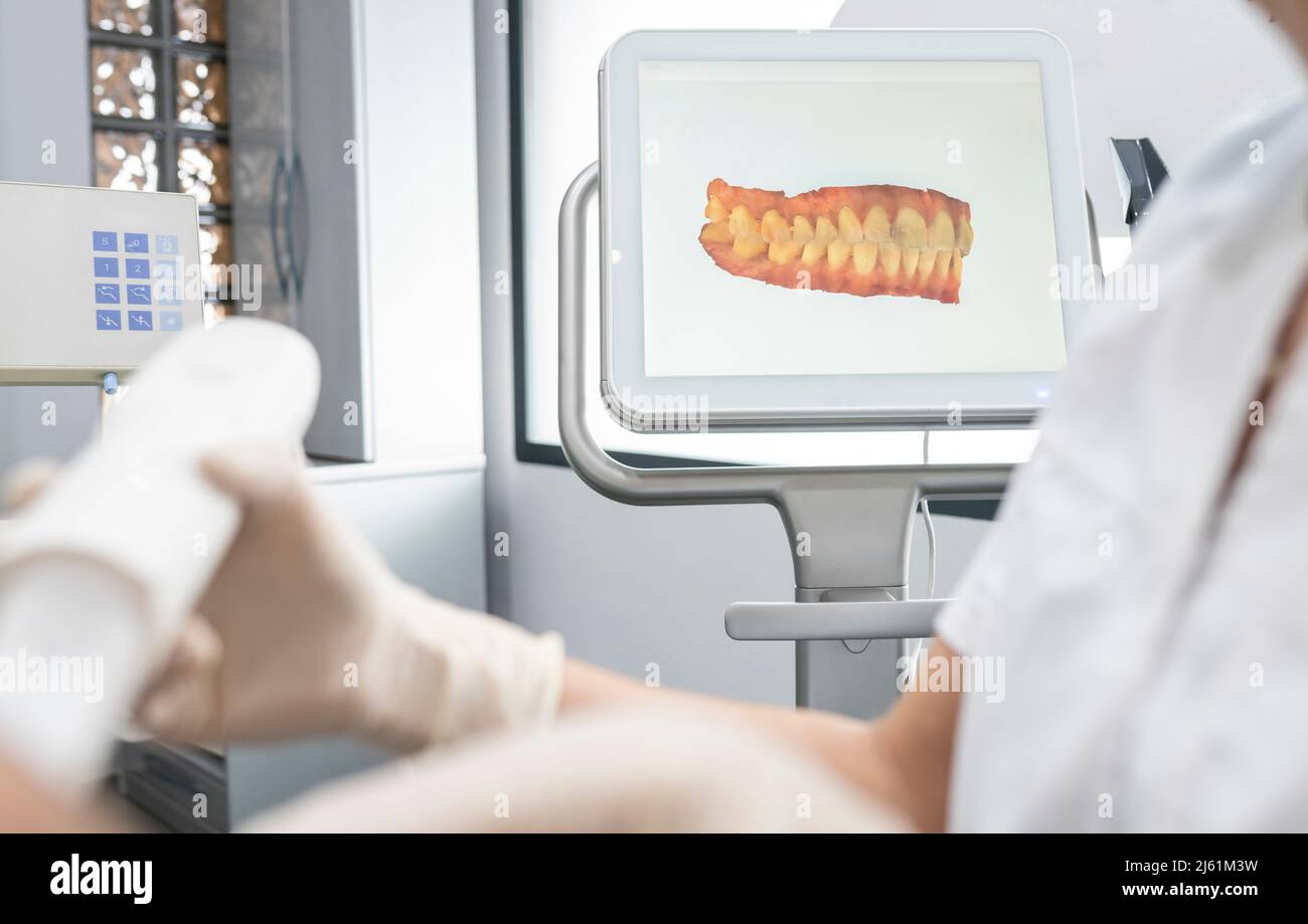 Dentist working by scanned image of teeth on monitor screen at dental ...