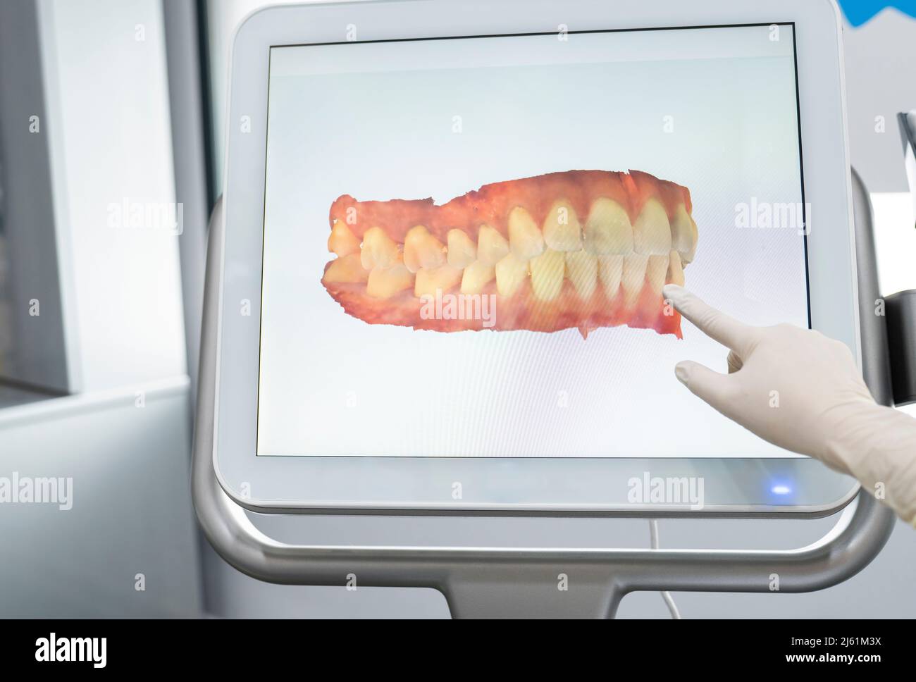Dentist pointing on scanned image of teeth on monitor screen at medical ...