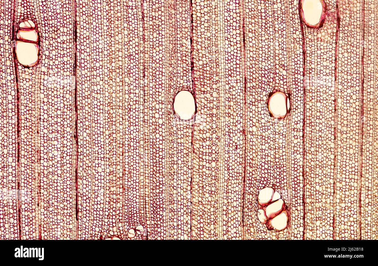 Balsa Ochroma wood - Africa - Microscope slide Stock Photo - Alamy