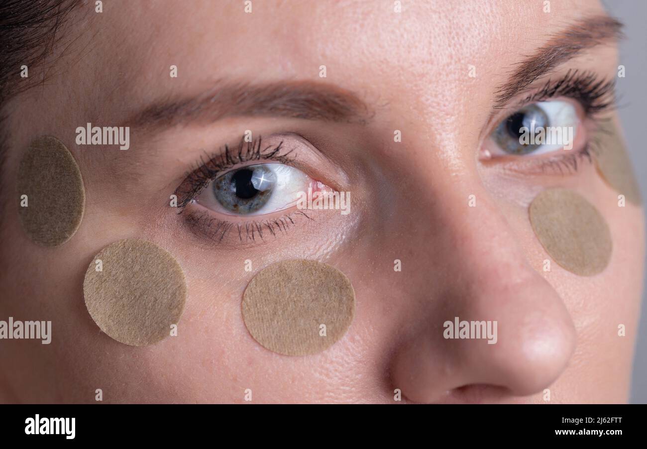 Medical herbal patch for the girl around the eyes to remove bags under ...