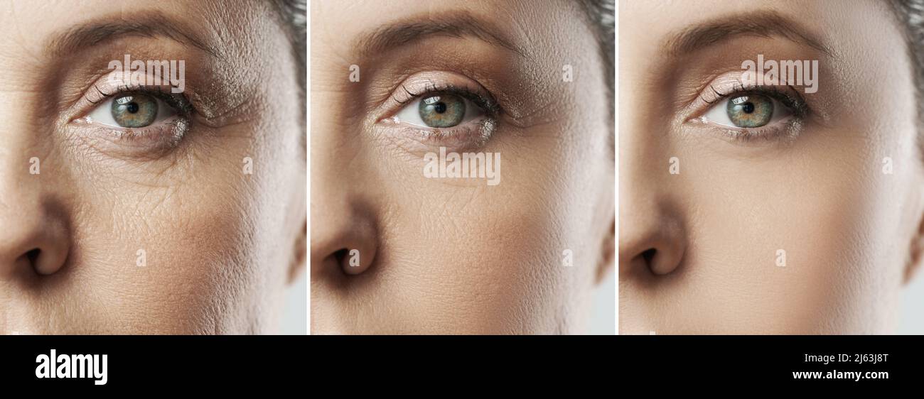 Female face after incredible rejuvenation process or heavy retouching ...