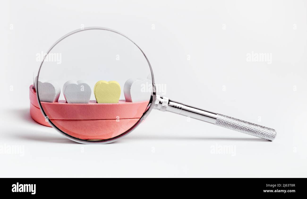 Caries diagnosis hi-res stock photography and images - Alamy