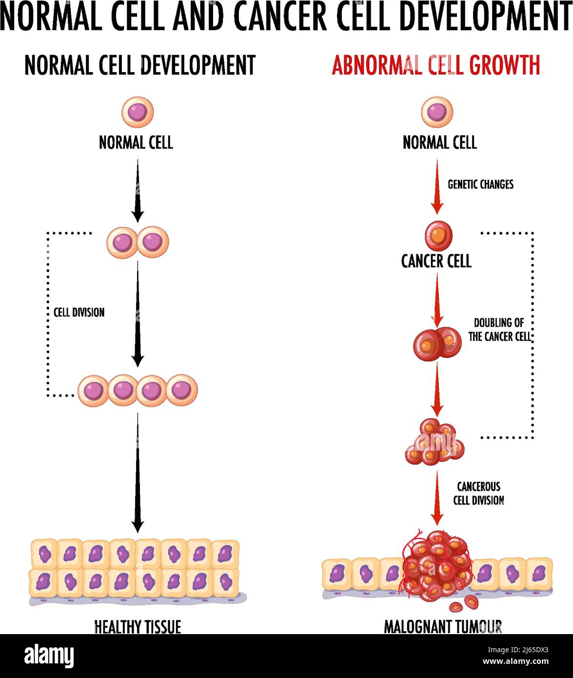 Diagram showing normal and cancer cell development illustration Stock ...