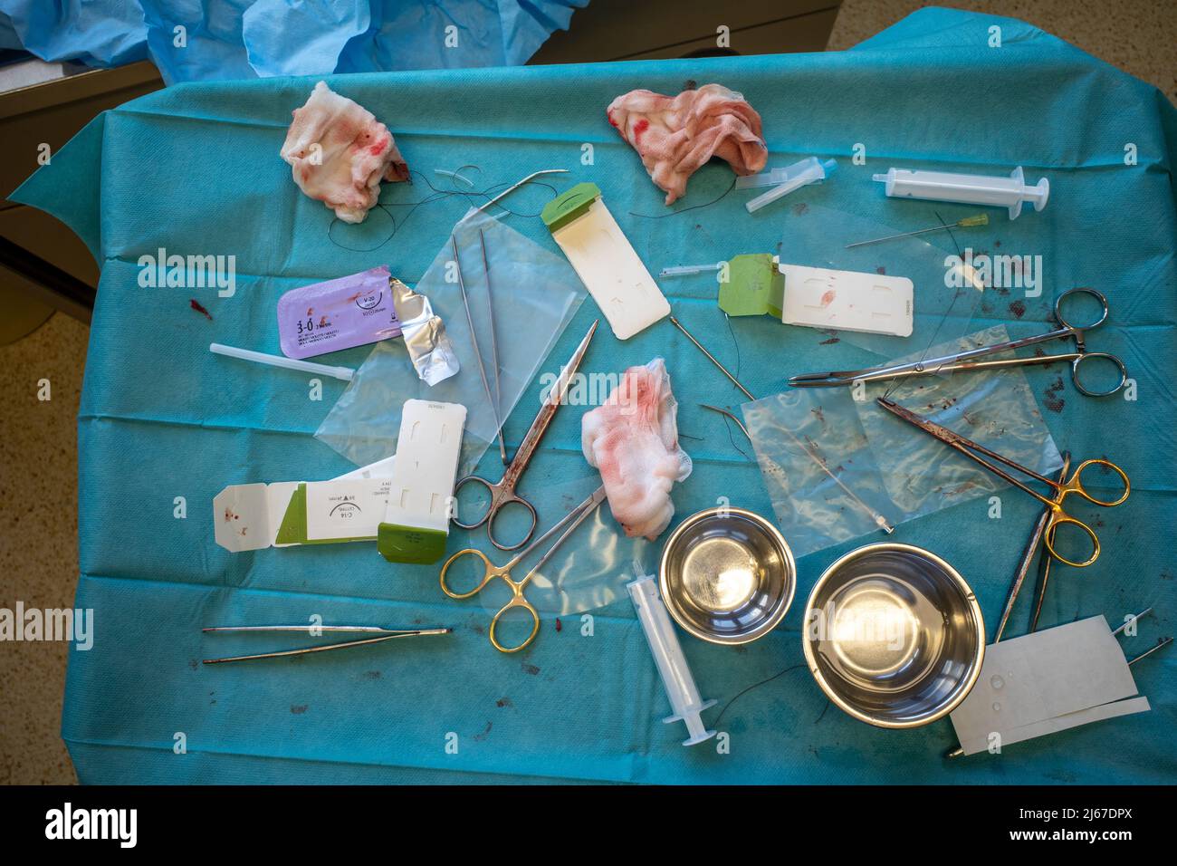 in an operating room there is a used operating table with instruments ...
