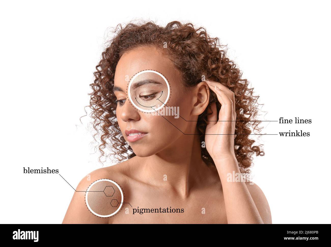 Beautiful young African-American woman with non-perfect skin on white ...