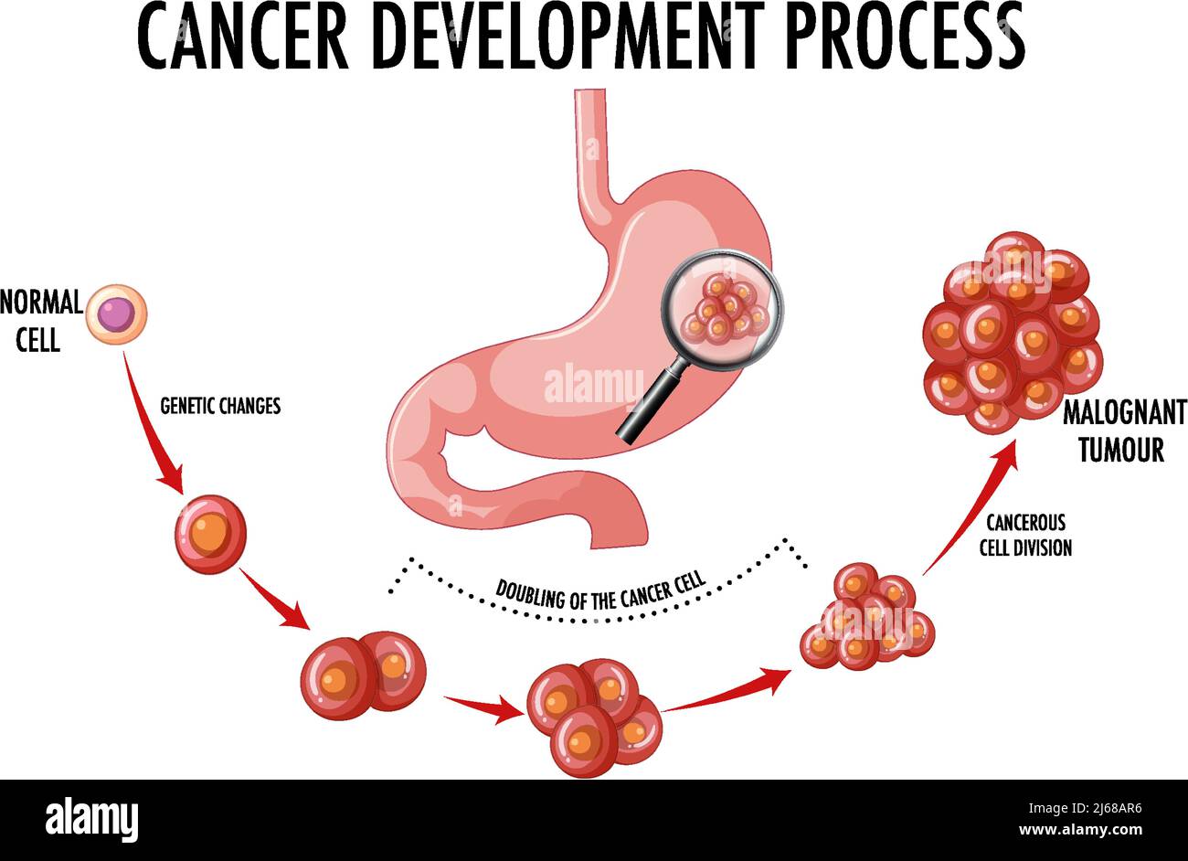 Diagram showing cancer development process illustration Stock Vector ...