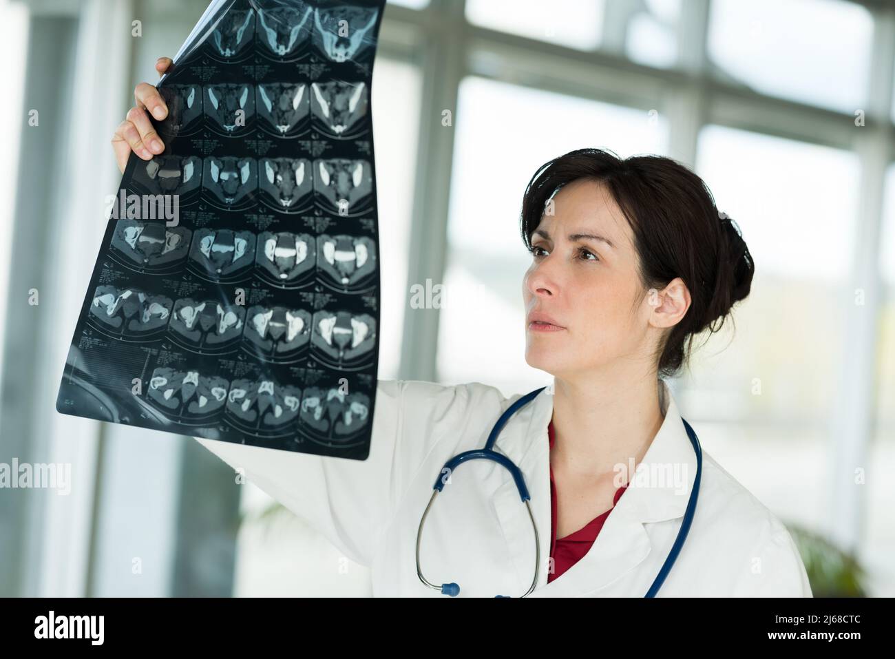radiologist woman checking x ray Stock Photo - Alamy
