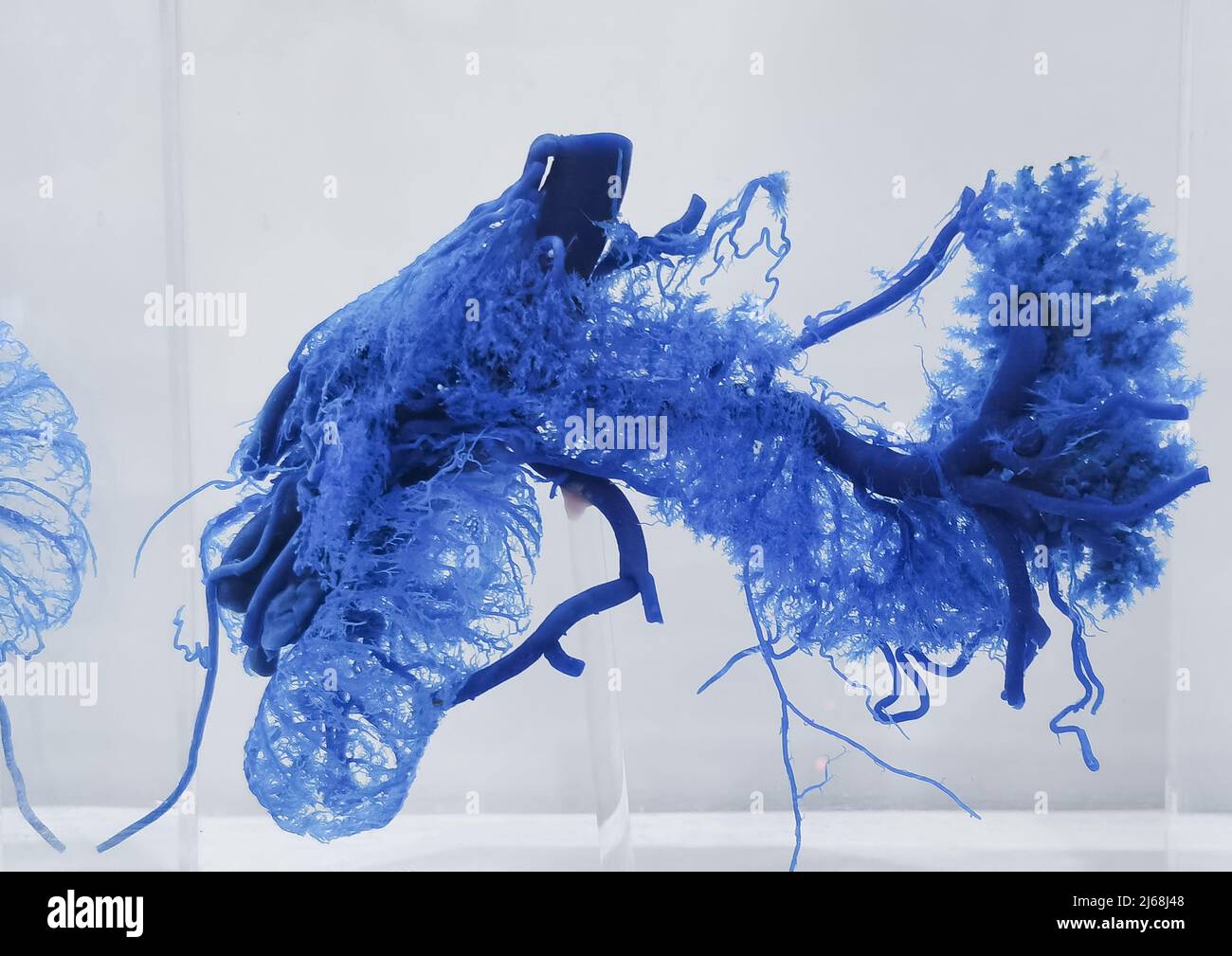 Organ blood vessel casting Stock Photo - Alamy