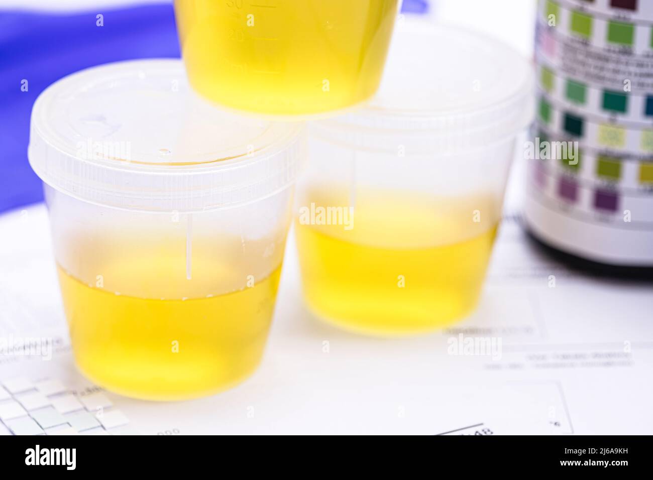 urine vial in laboratory, toxicology or routine examination, vials with ...