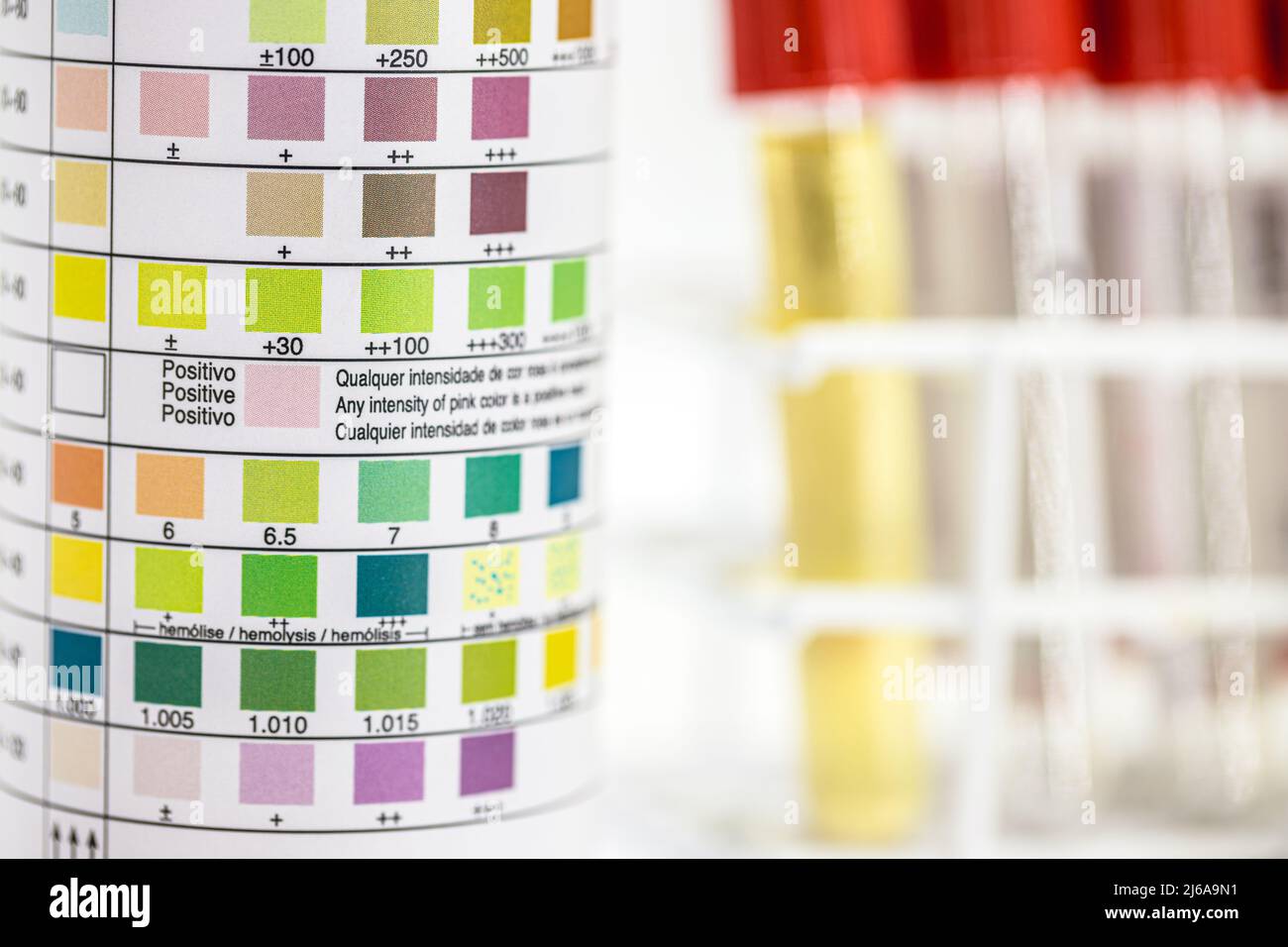 vial with test strips for urinalysis used to control ketosis and other ...
