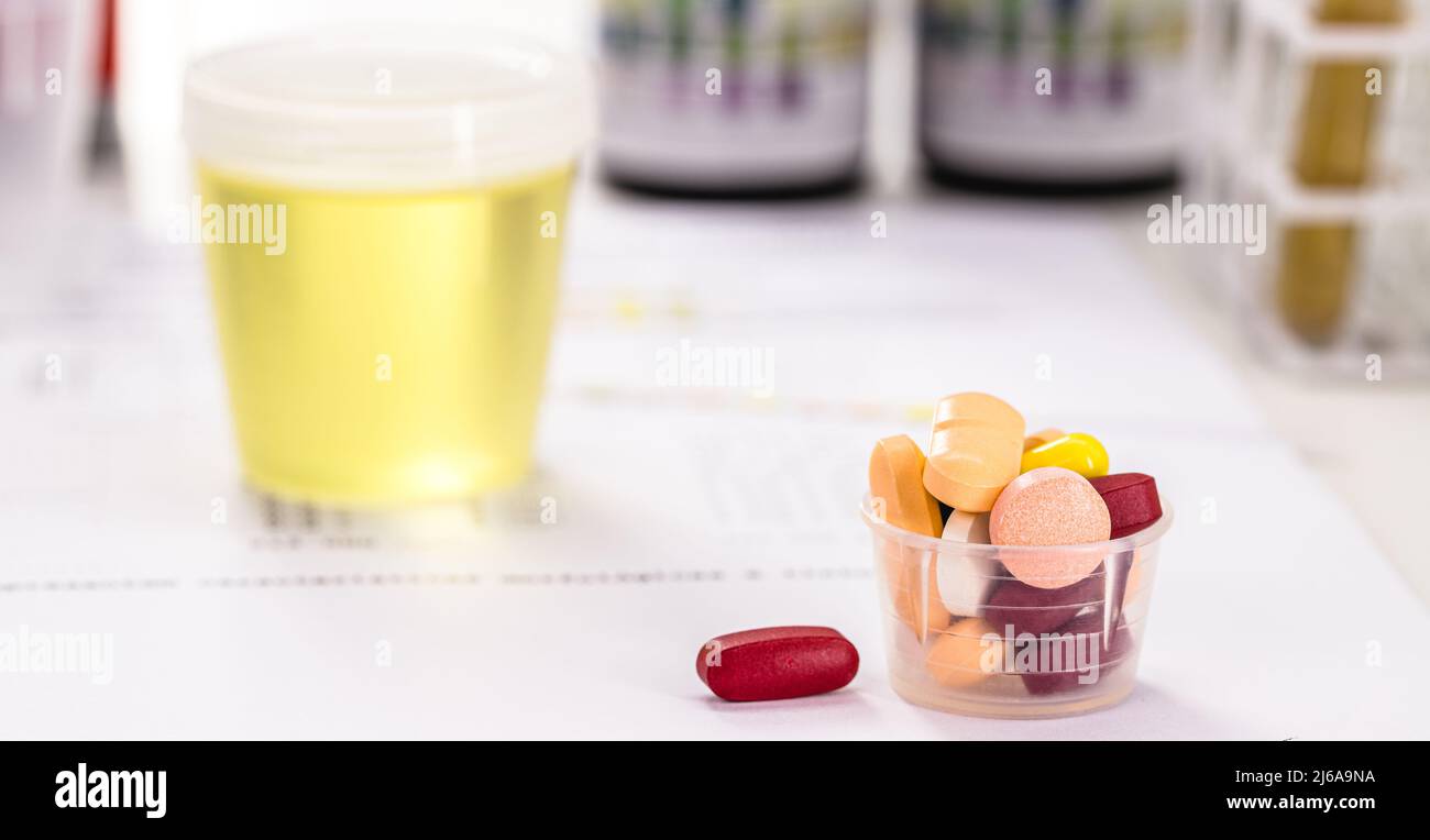 oral pills for urinary tract infection problems, lab tests and bottles ...