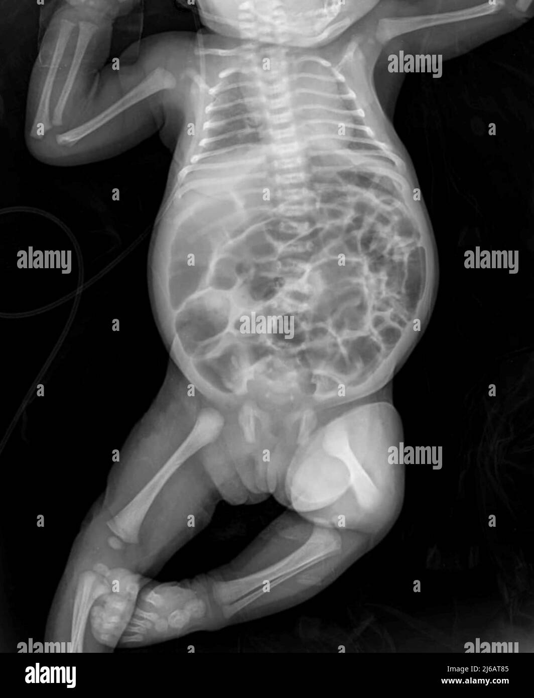 One day old baby, X-ray Stock Photo - Alamy