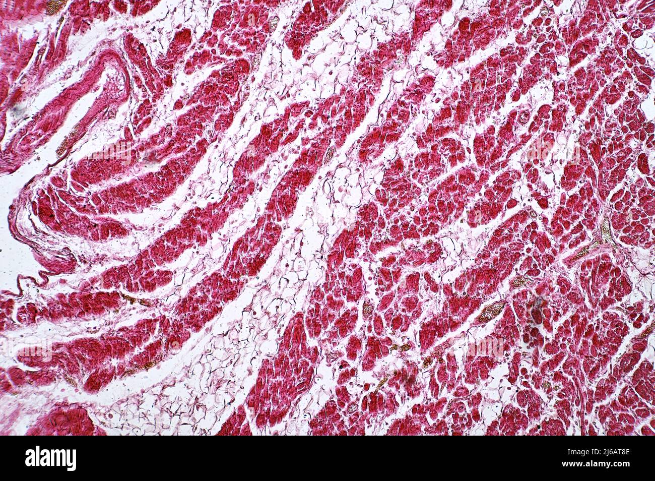 Fatty heart, light micrograph Stock Photo - Alamy