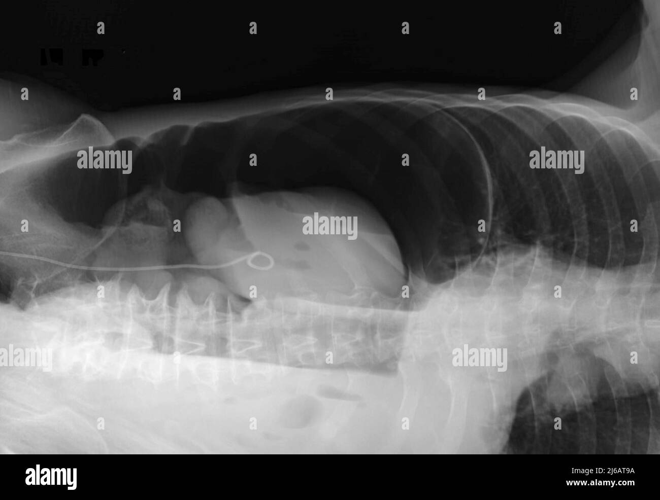 Lateral abdominal x ray hi-res stock photography and images - Alamy