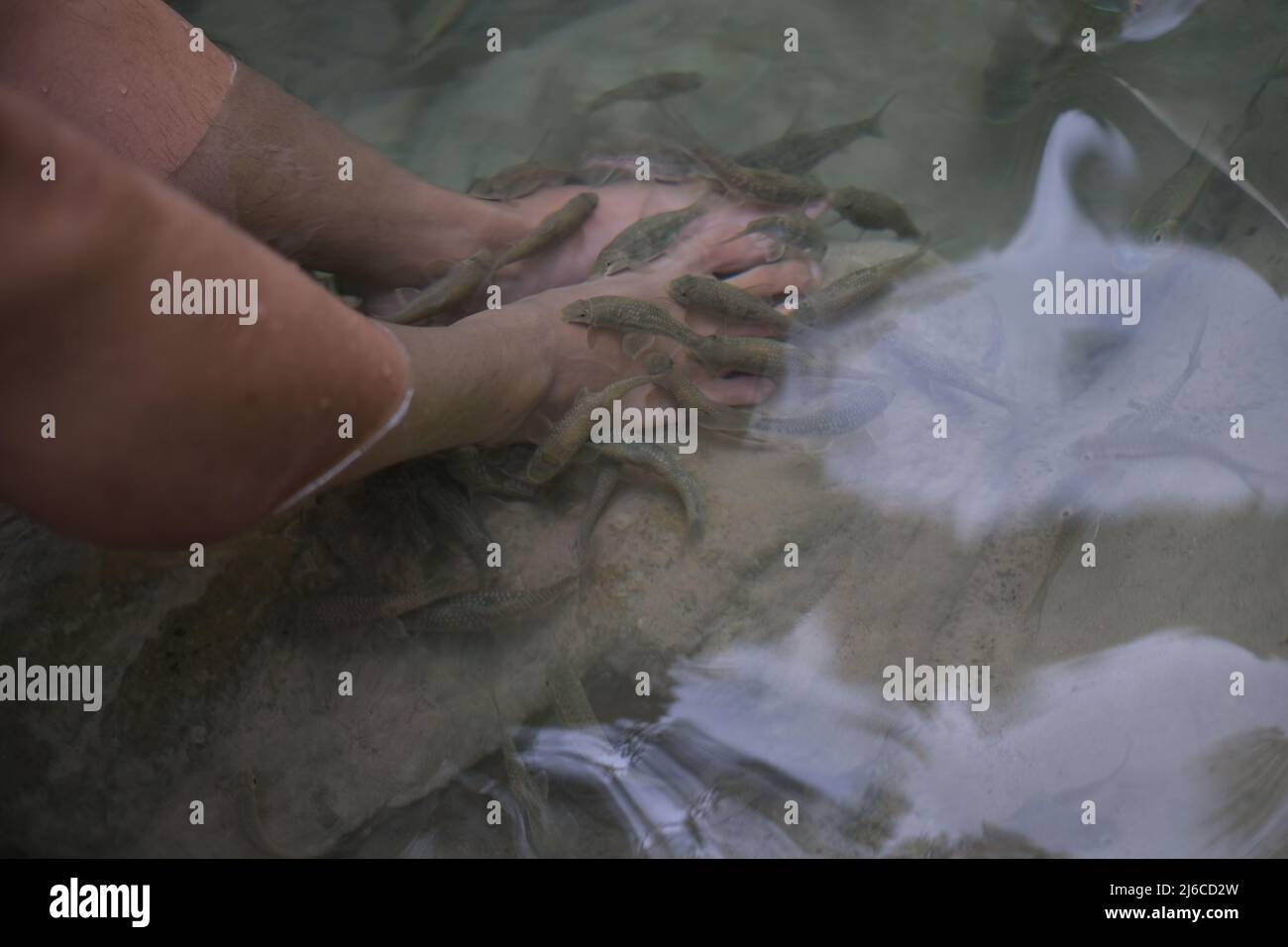Eaten alive: a numerous fish sticks to human feet, consuming small ...
