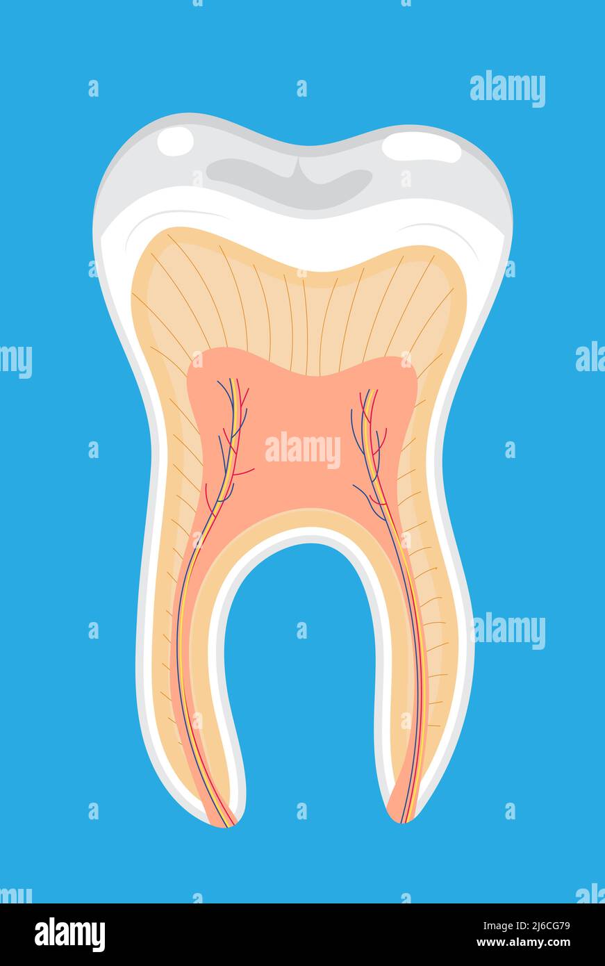 Caries, tartar or tooth cyst treatment icon vector on the blue ...