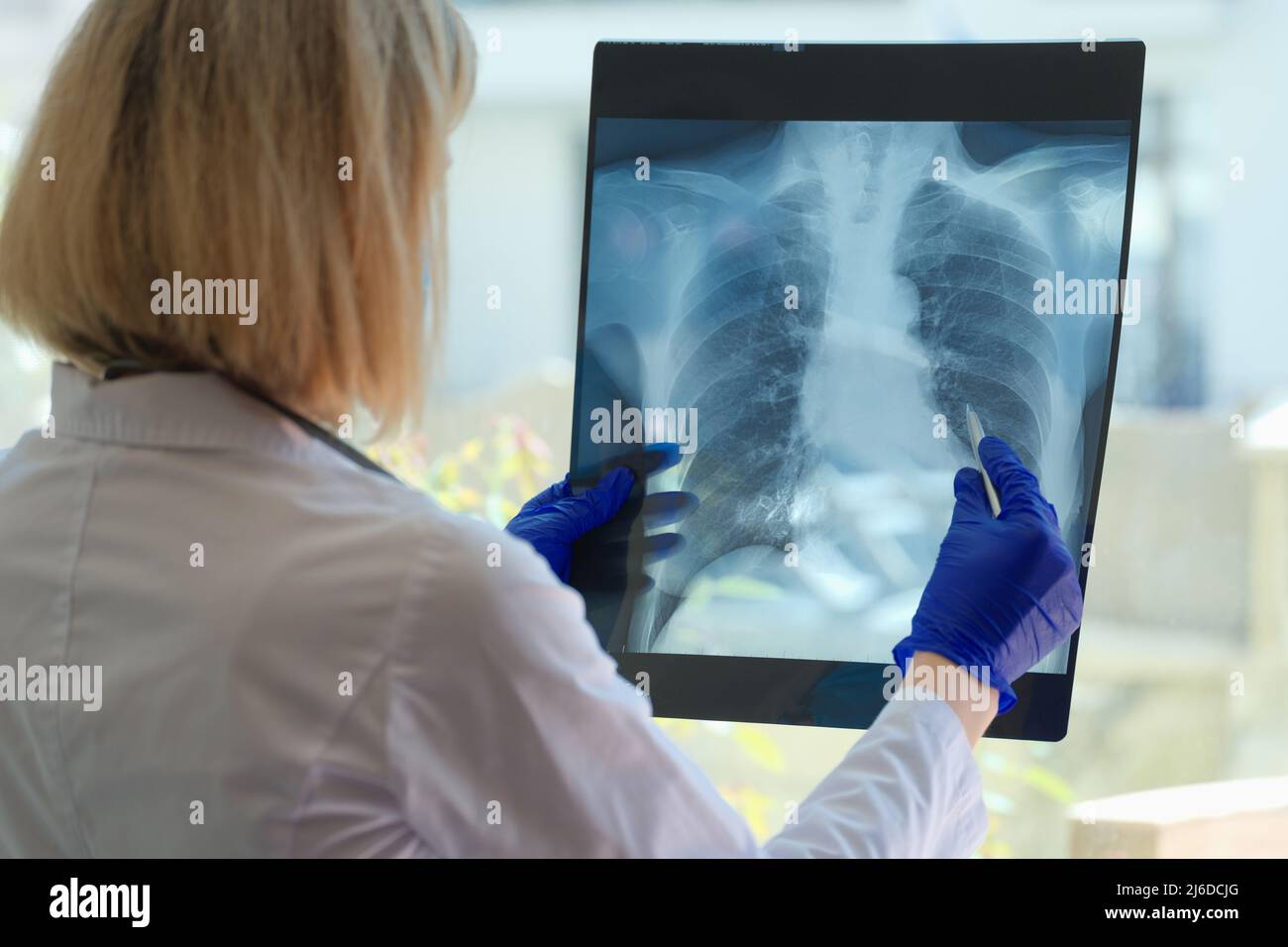 Obstructive lung diseases hi-res stock photography and images - Alamy