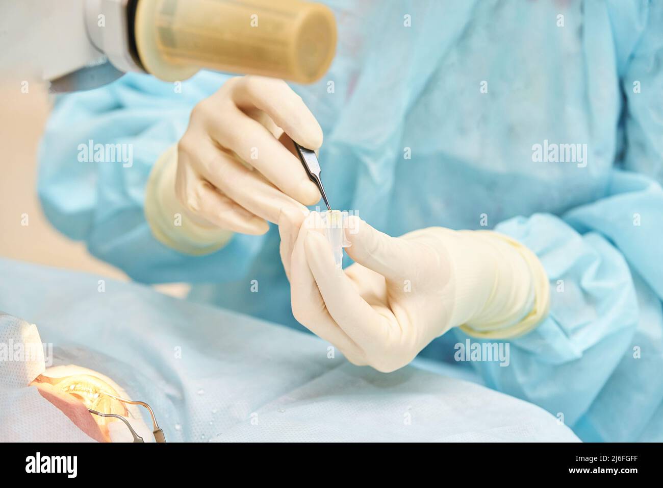 Ophthalmology laser microscope operation. Doctor surgery in clinic ...