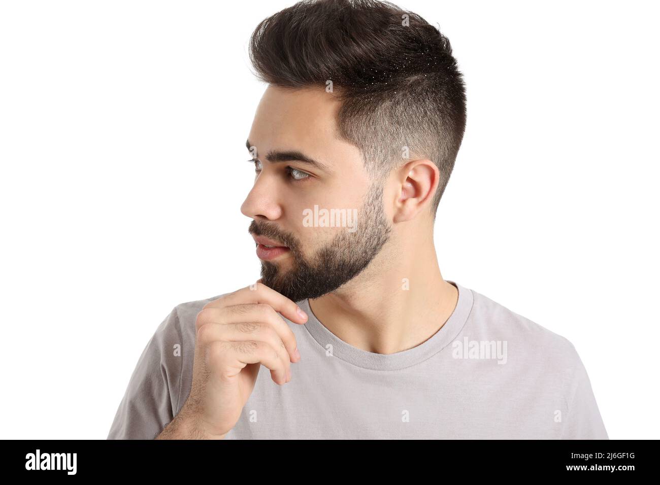 Young man with problem of dandruff isolated on white Stock Photo - Alamy