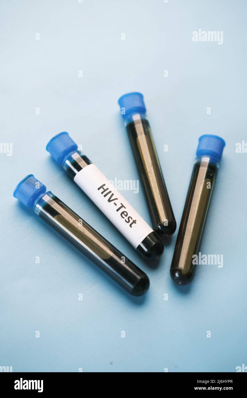 Positive hiv blood test hi-res stock photography and images - Alamy