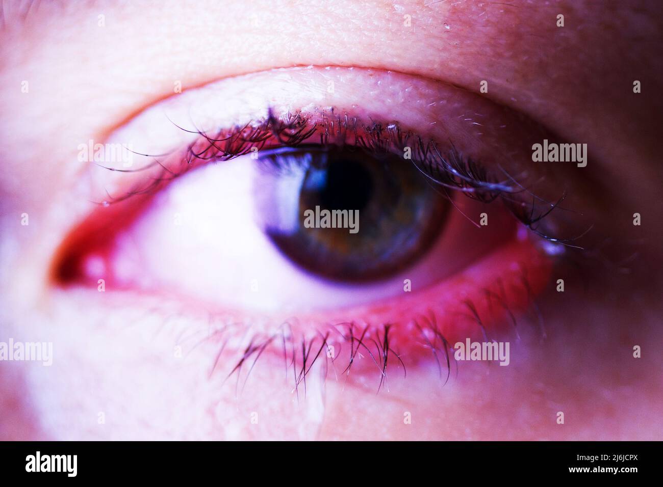 Eye wet and red from tears Stock Photo - Alamy