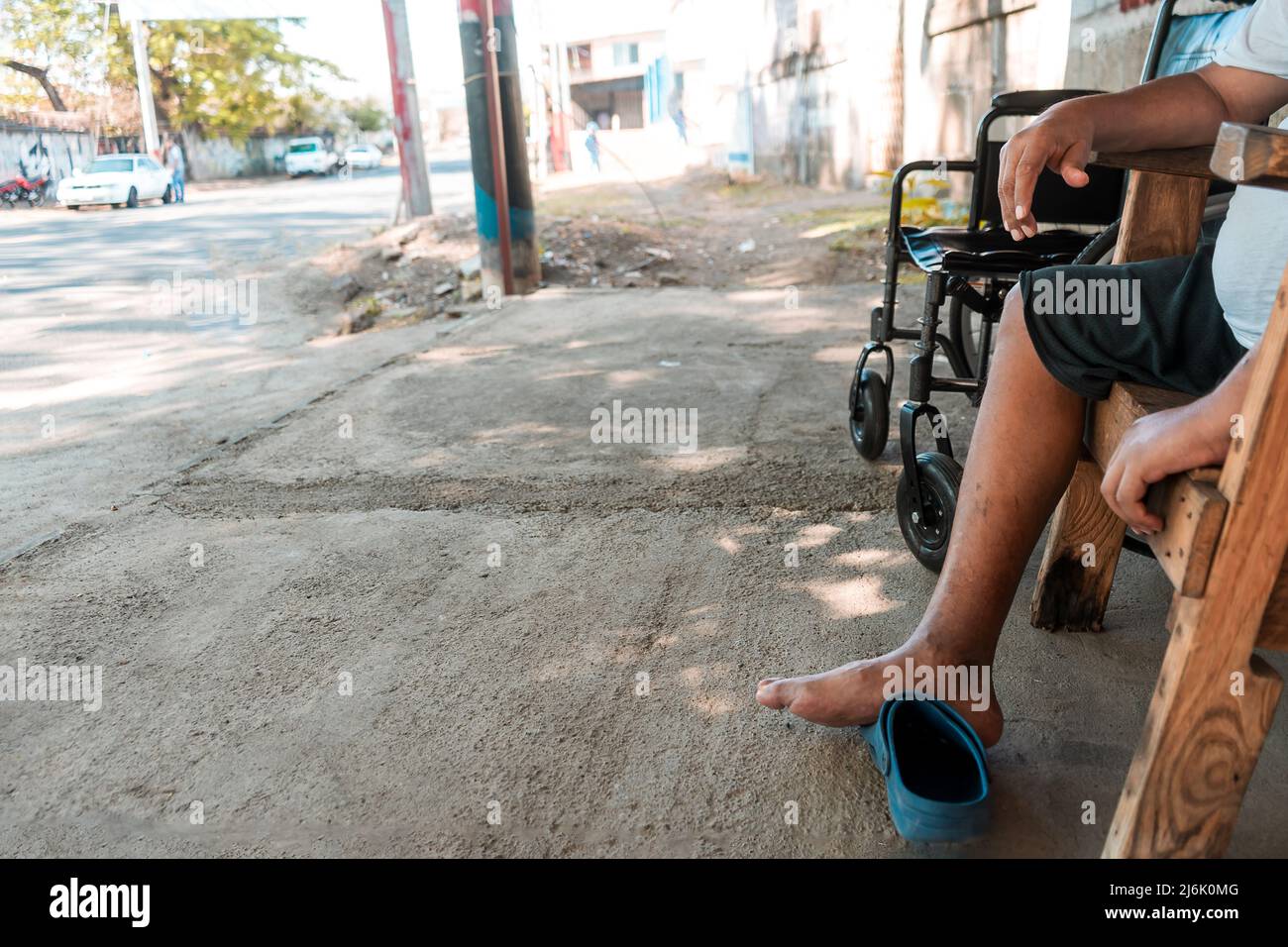 Closeup of a disabled Latino man, without a leg due to diabetes sitting ...