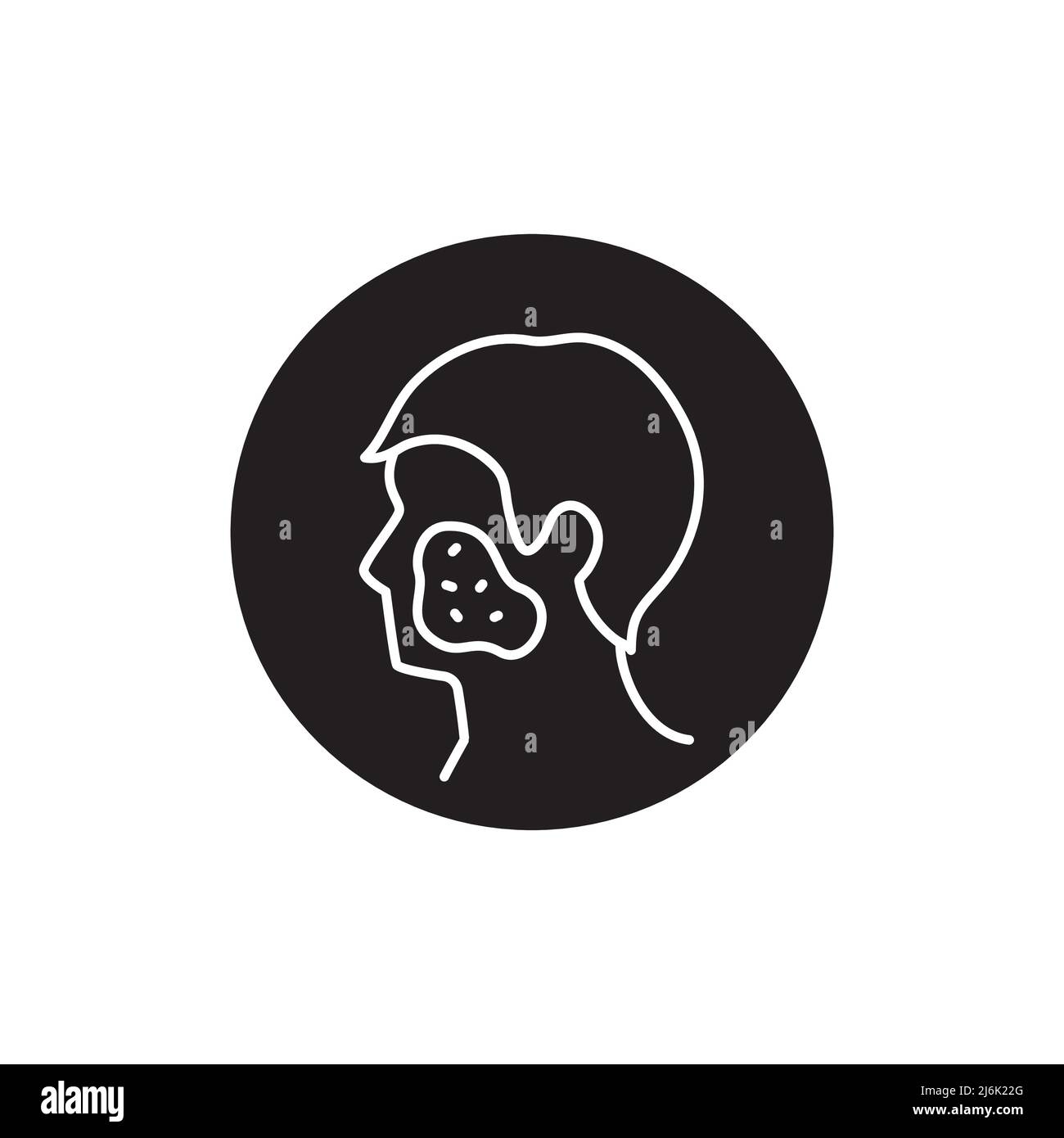 Rosacea Color Line Icon Dermatology Disease Isolated Vector Element