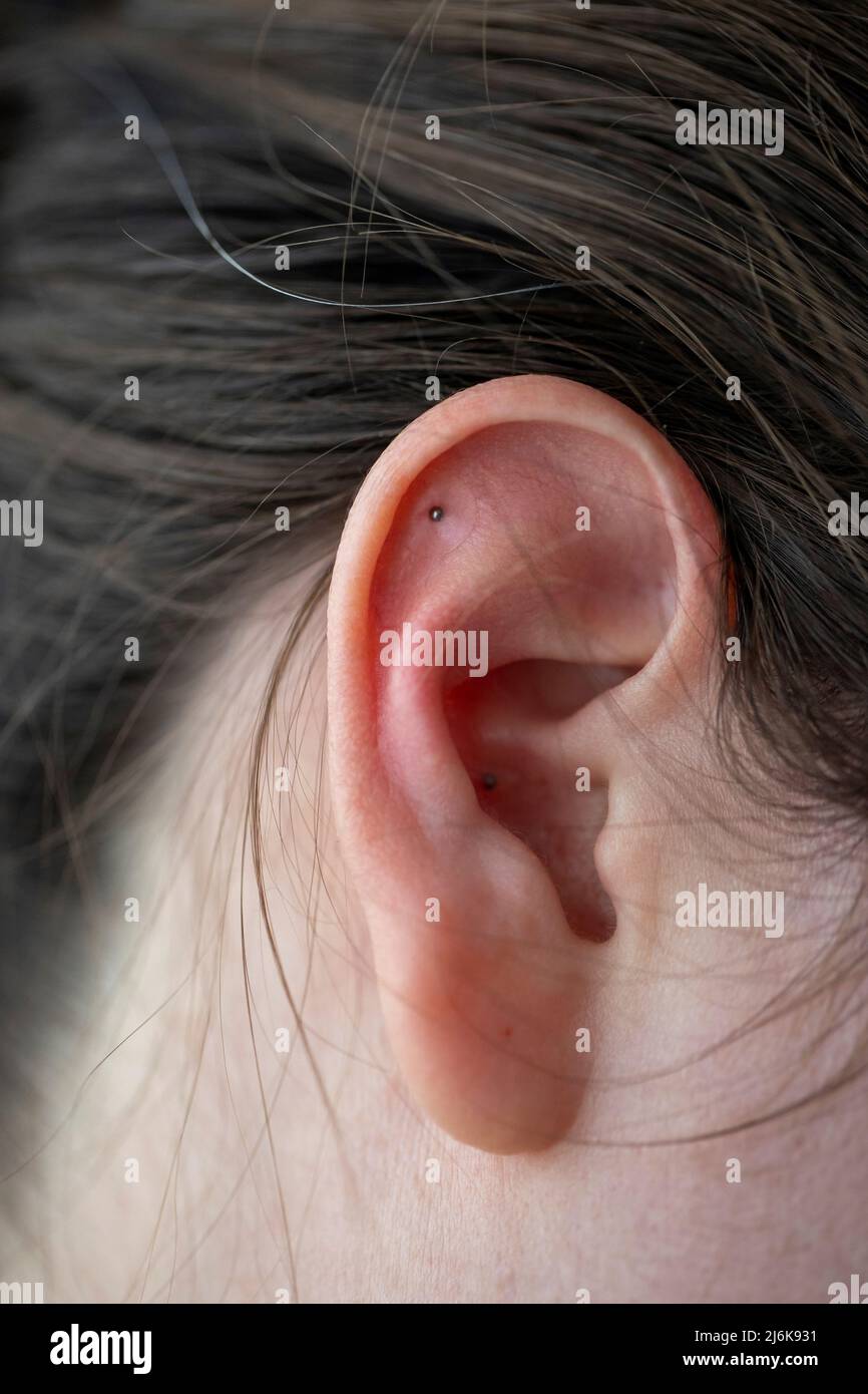 A sideways portrait of the ear of a woman with acupressure ear seeds in ...