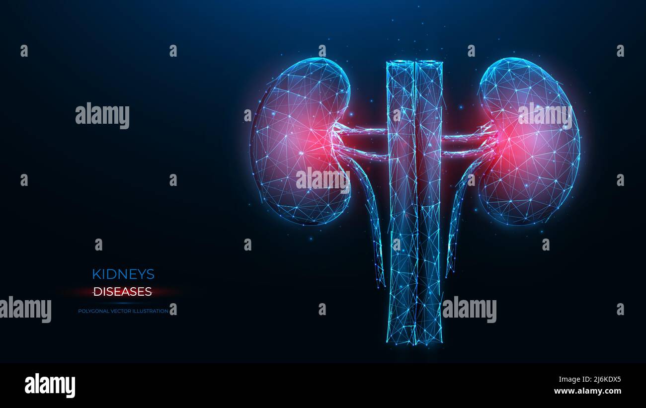 Pain painful kidneys Stock Vector Images - Alamy