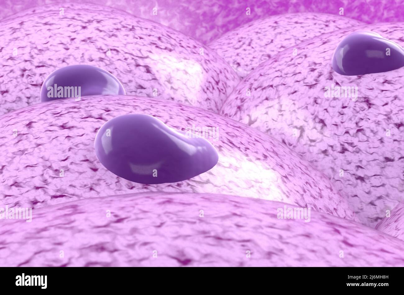 Testicular Cancer Cells In The Testicle Cortex Closeup View 3d