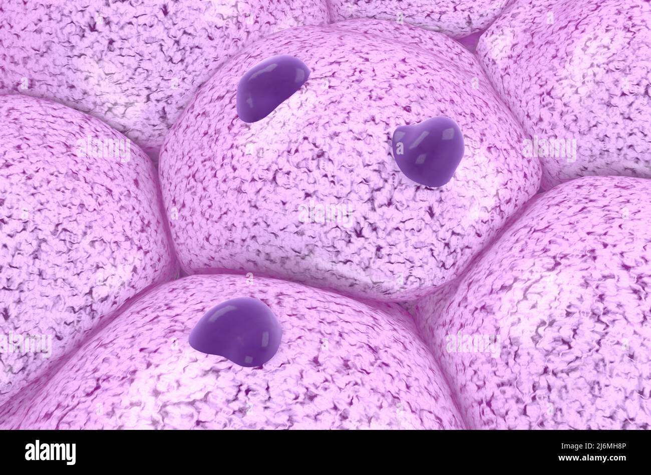 Testicular Cancer Cells In The Testicle Cortex Isometric View 3d