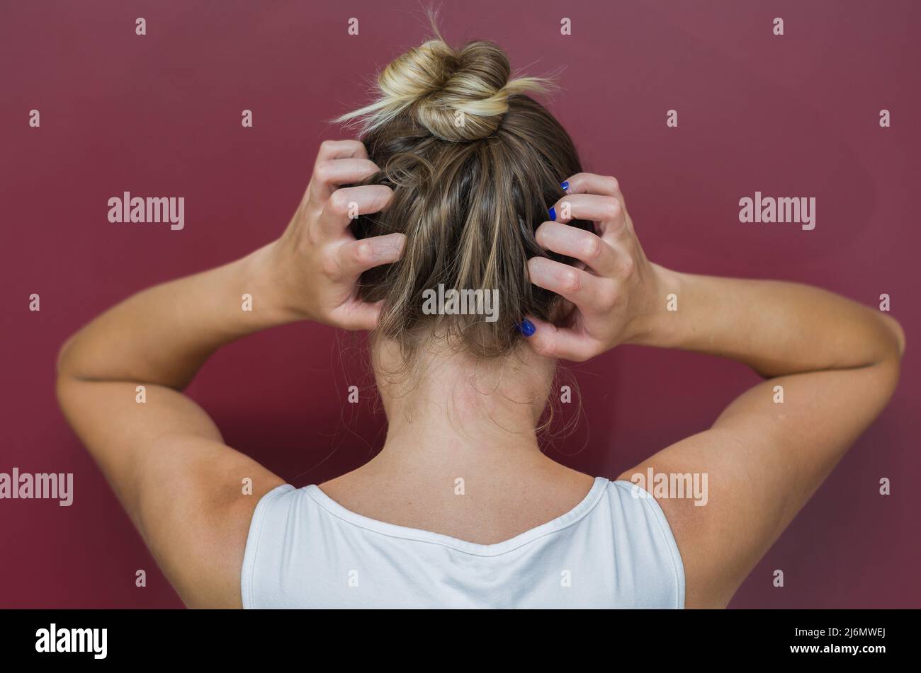 Dandruff woman scalp scratching hi-res stock photography and images - Alamy