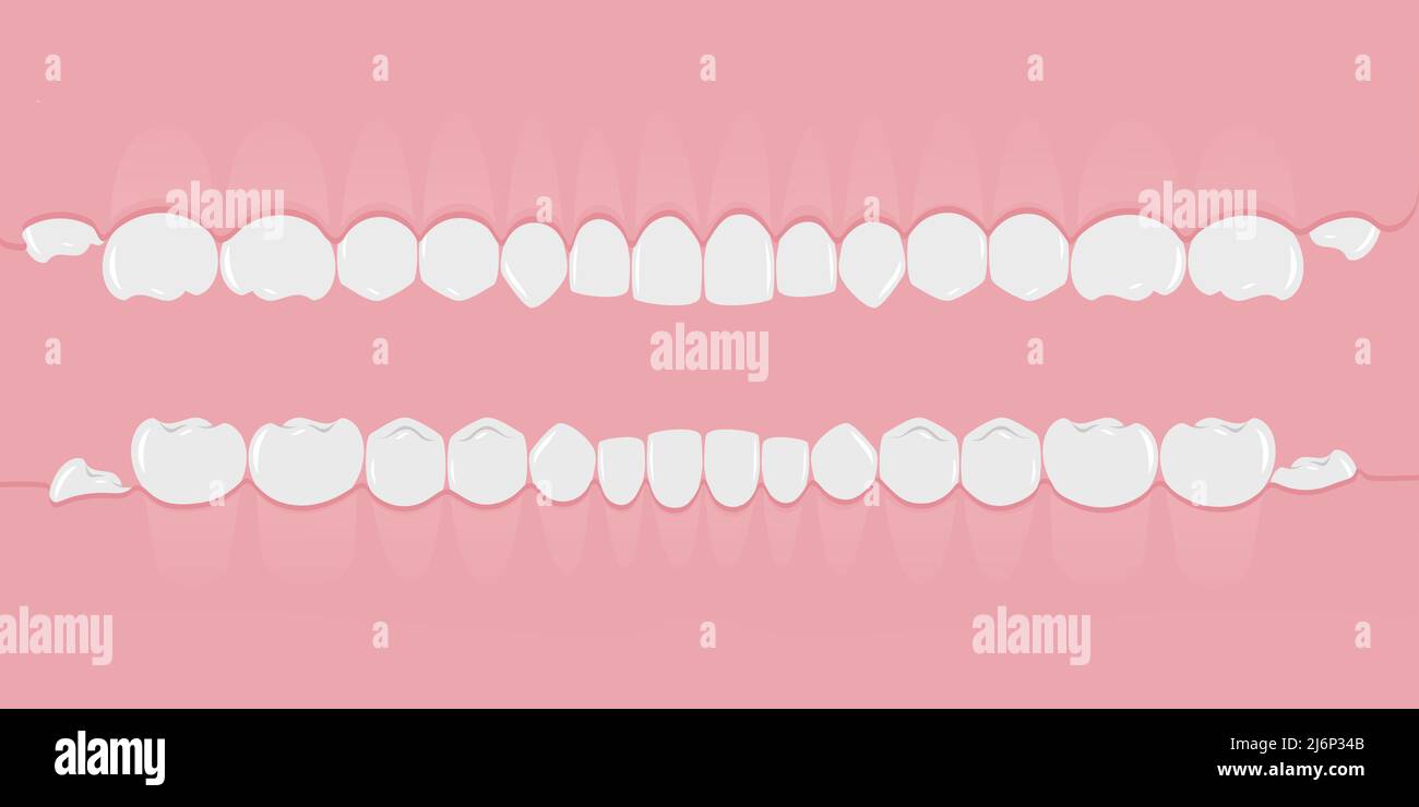Healthy white human teeth in the gum in a row. Teeth without roots ...
