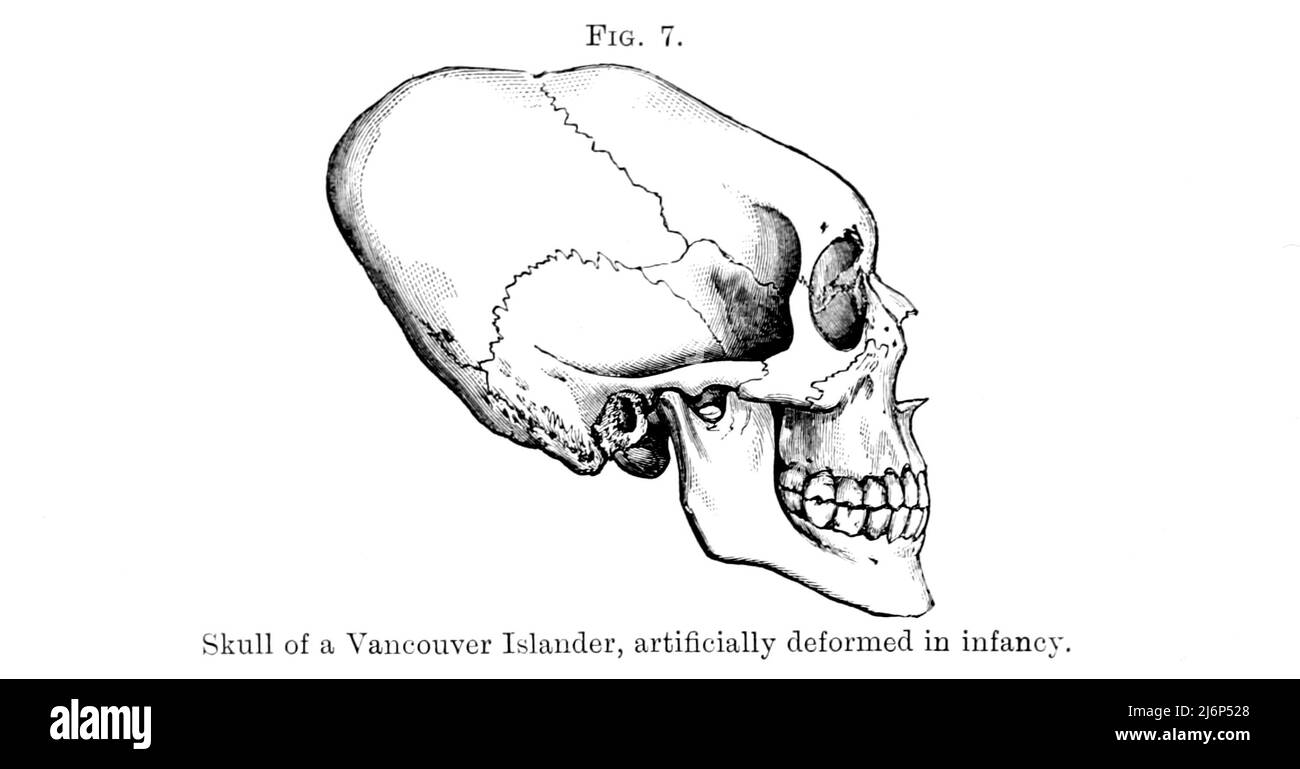 Human skull specimen hi-res stock photography and images - Alamy